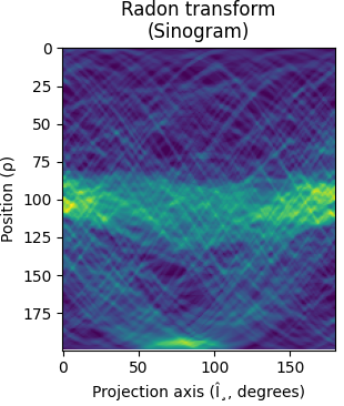 Feature extraction using radon transform